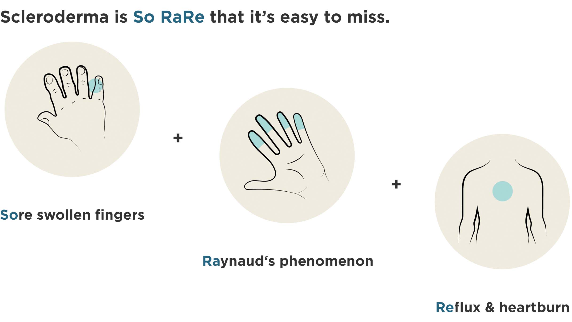 Stretches For Scleroderma Orofacial Manifestations And