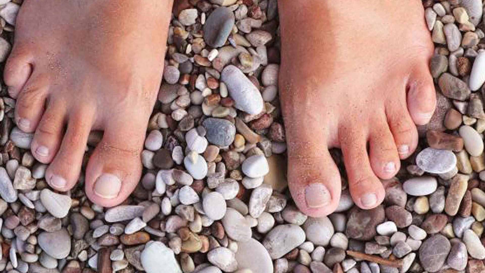 Symptomer forbundet med sklerodermi | MTS