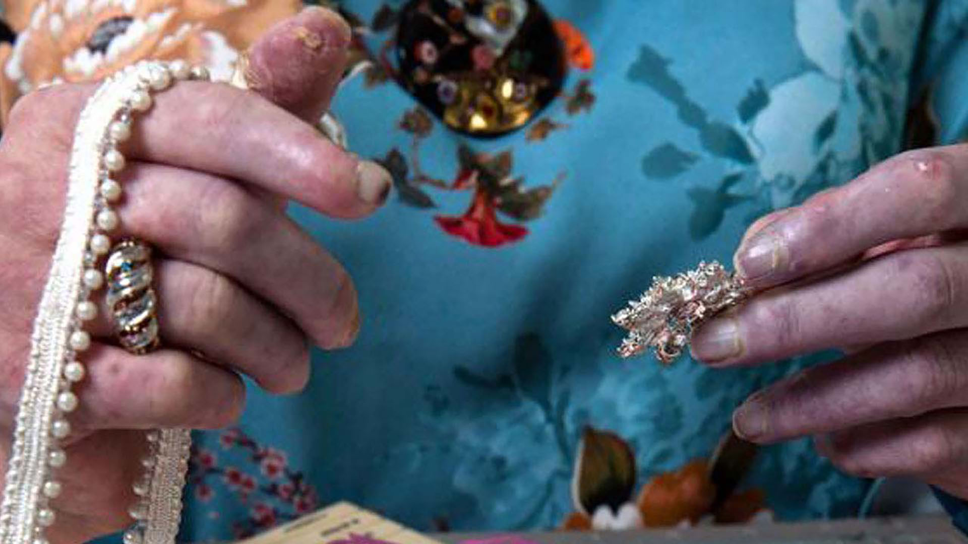 Symptomer forbundet med sklerodermi | MTS