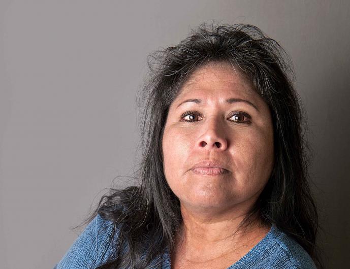 Symptomer forbundet med sklerodermi | MTS