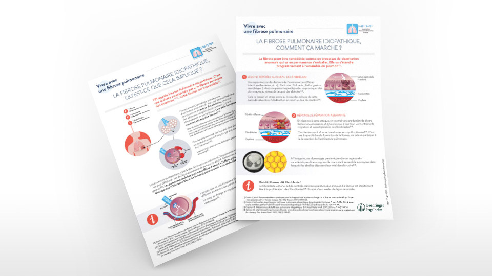 Fibrose Pulmonaire (FP) : Brochures & Fiches Pratiques | Vivre avec une ...