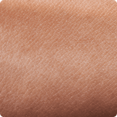 Generalized Pustular Psoriasis (GPP) | Boehringer Ingelheim