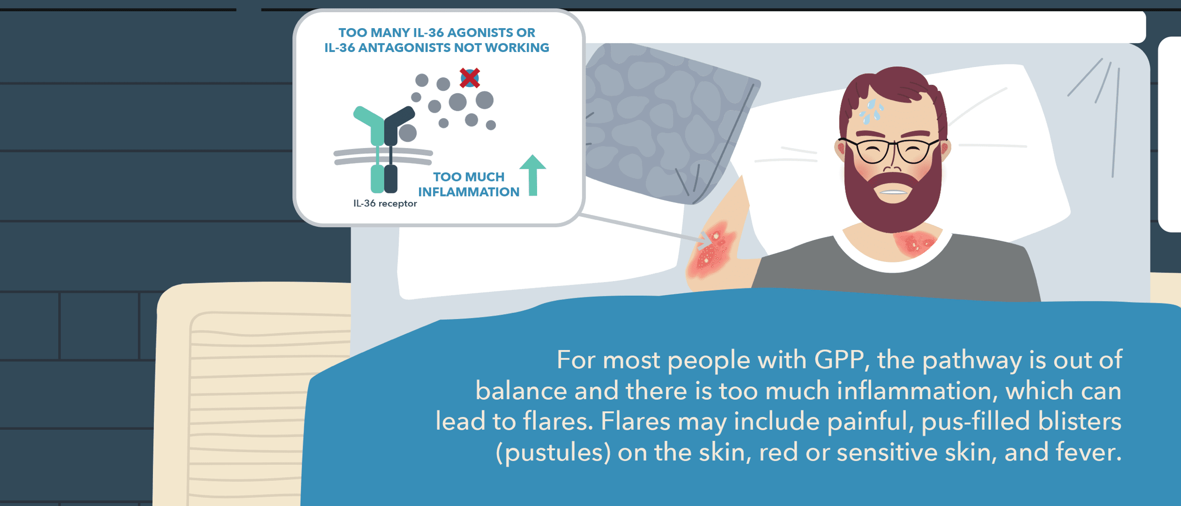 Generalized Pustular Psoriasis Symptoms | Boehringer Ingelheim