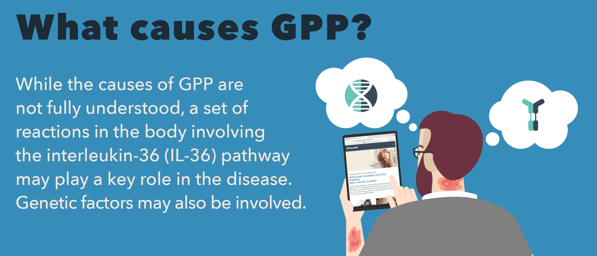 Generalized Pustular Psoriasis Symptoms | Boehringer Ingelheim