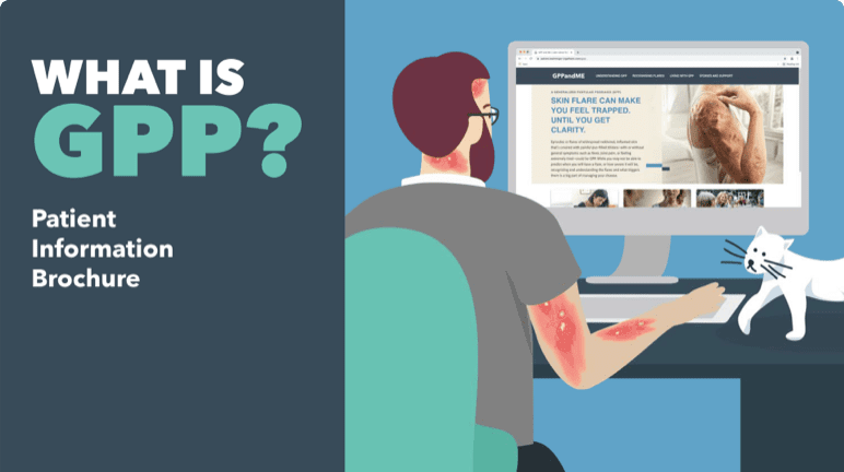 Generalized Pustular Psoriasis Symptoms | Boehringer Ingelheim