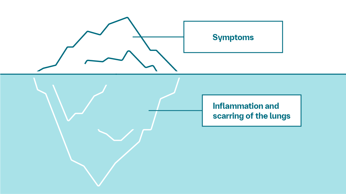 Understanding Disease Progression | Life with Pulmonary Fibrosis