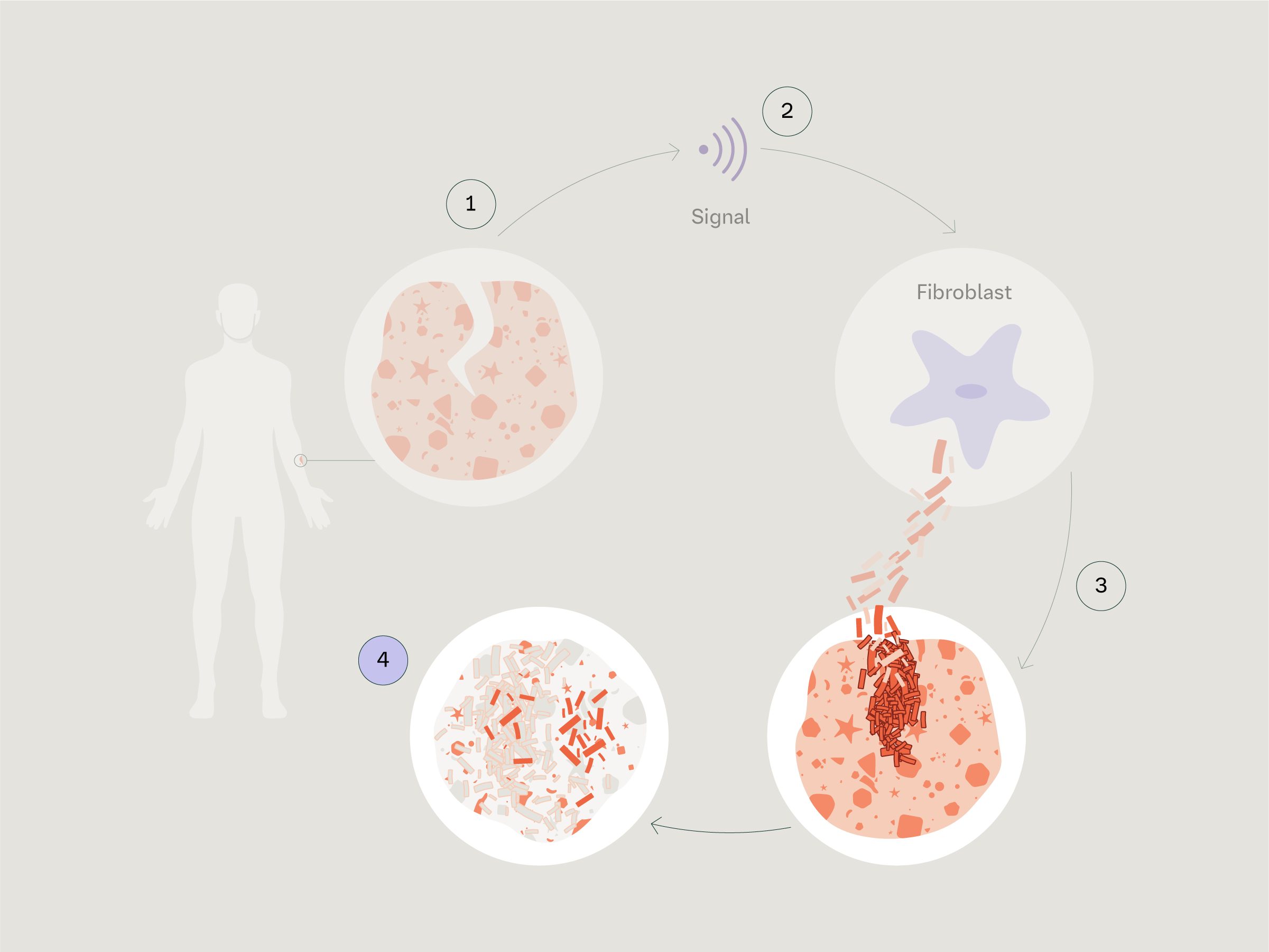 What is systemic sclerosis | More Than Scleroderma