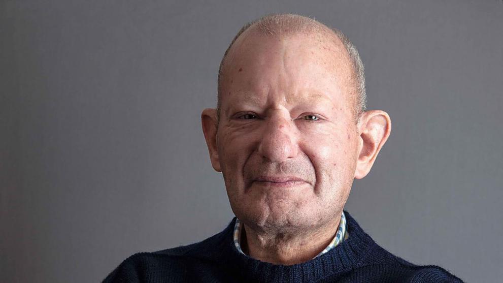 Scans and imaging | More Than Scleroderma