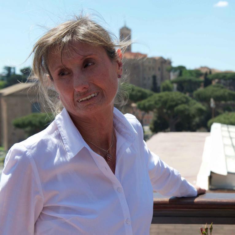 How scleroderma affects Grazia's family | More Than Scleroderma