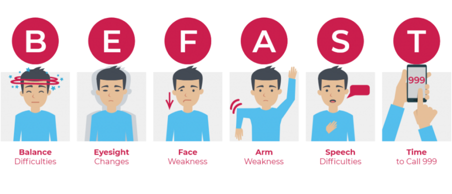 Stroke FAQs | Boehringer-Ingelheim