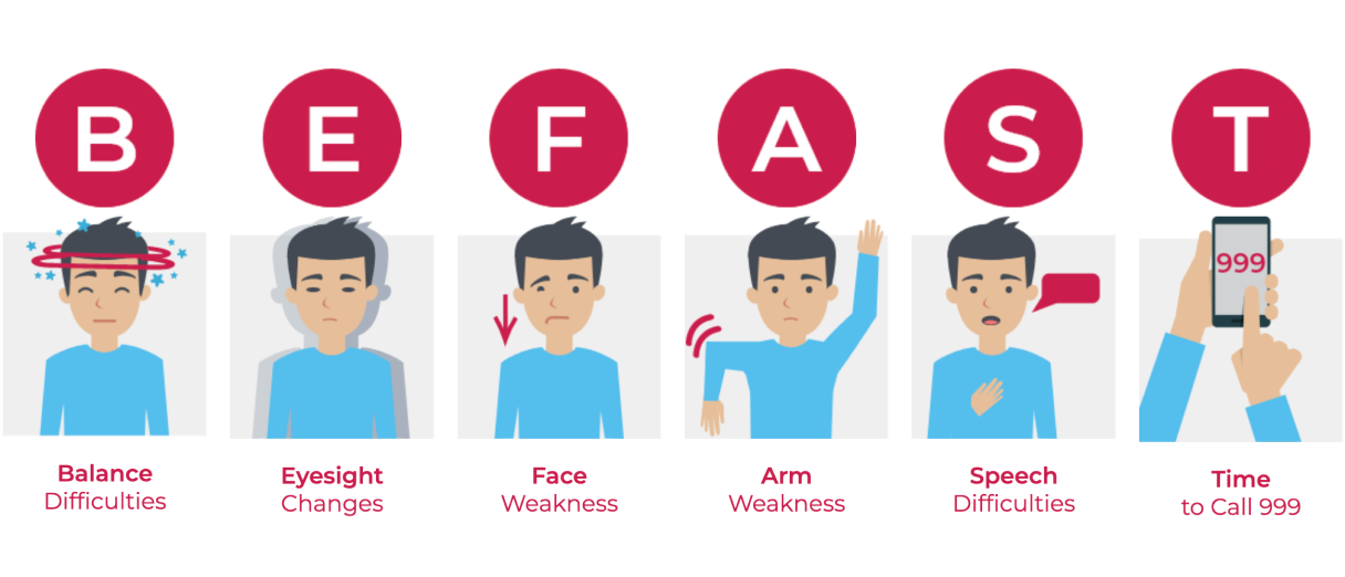 Understanding Stroke | Boehringer-Ingelheim