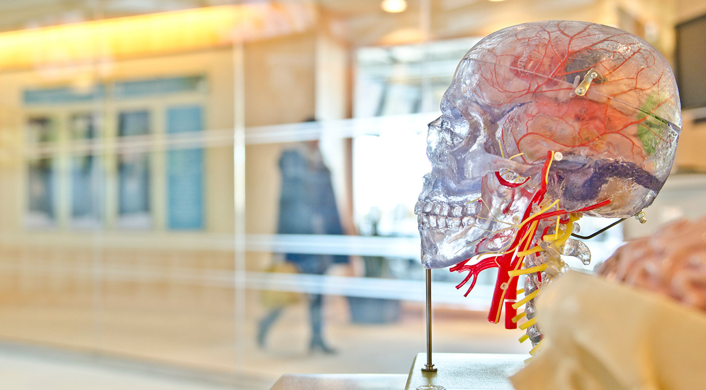 TROMBOSE EN BEROERTE Beroerte, CVA, | Boezemfibrilleren