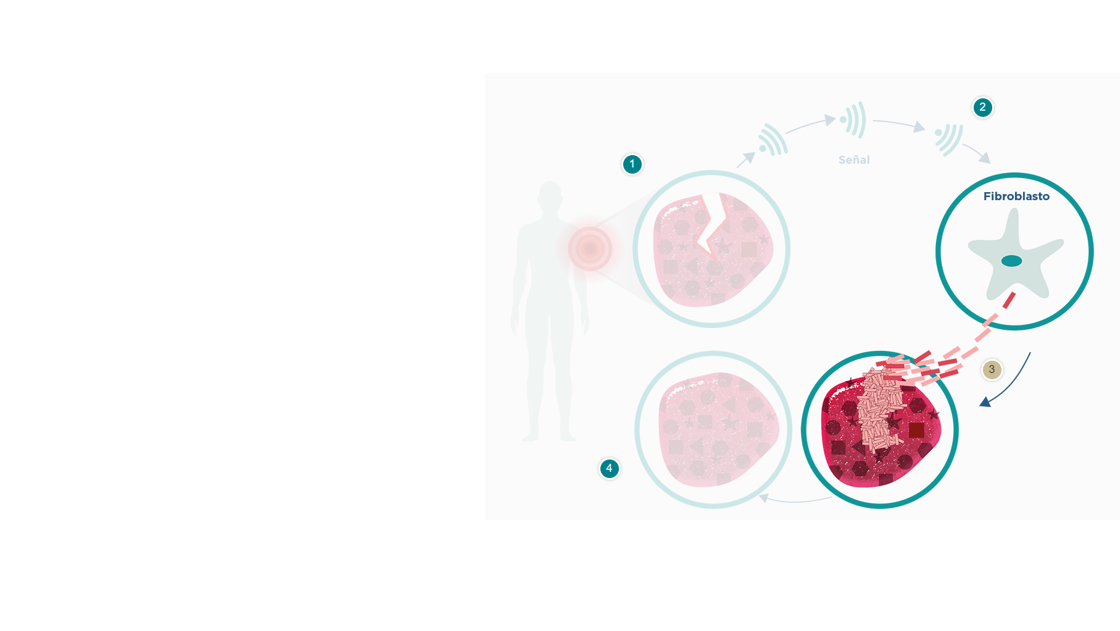 ¿Qué es la esclerosis sistémica? Más que esclerodermia