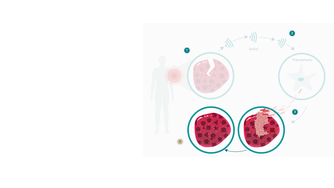 ¿Qué es la esclerosis sistémica? Más que esclerodermia