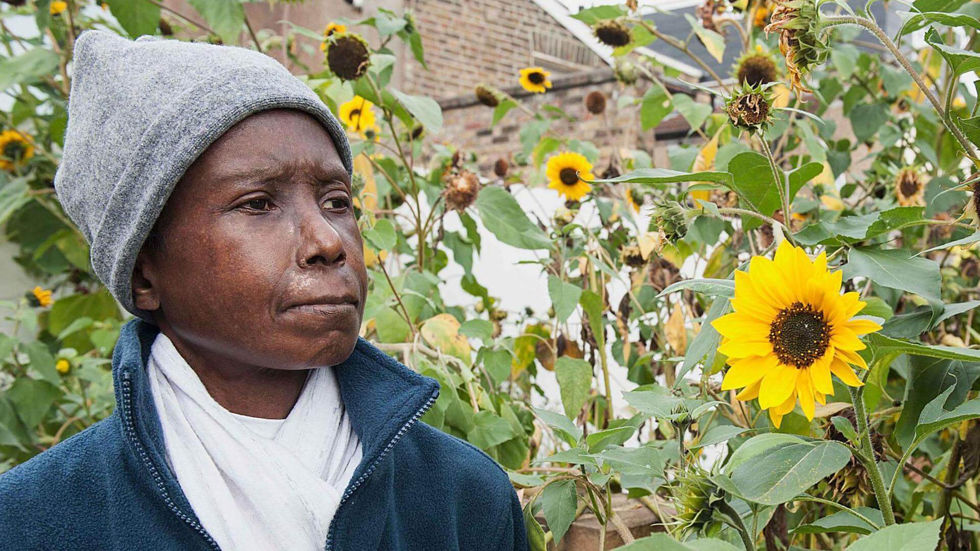 ¿Qué es la capilaroscopia? | Más que esclerodermia