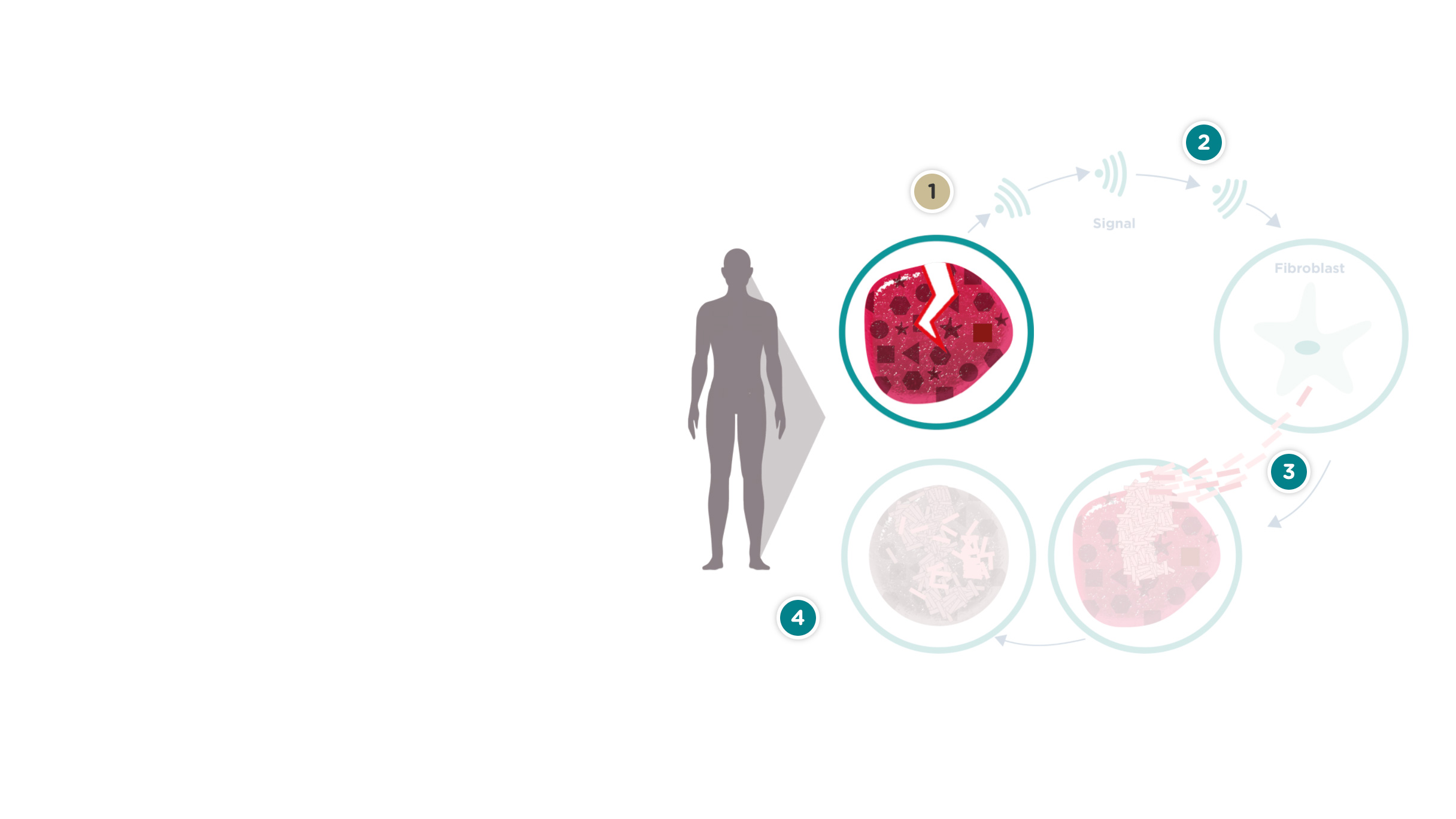 Vad är systemisk skleros | More Than Scleroderma