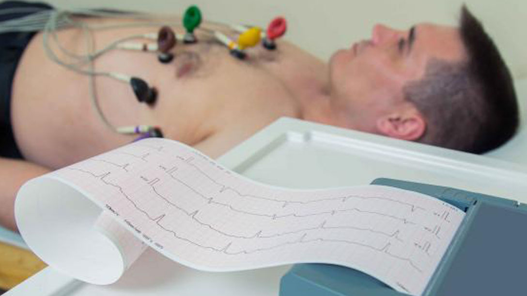 Hälsotester för hjärtat | Sklerodermi-mer än bara huden