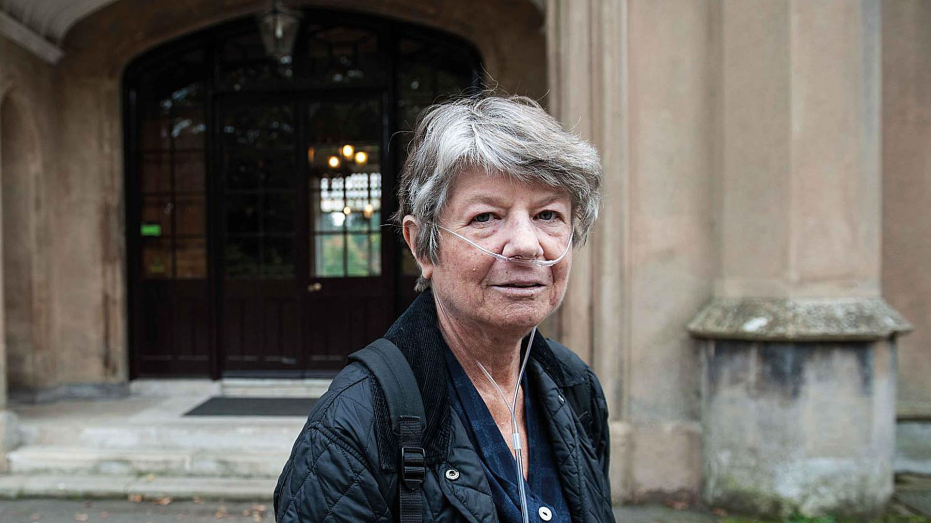 Interstitiell lungsjukdom (ILS) | Systemisk skleros