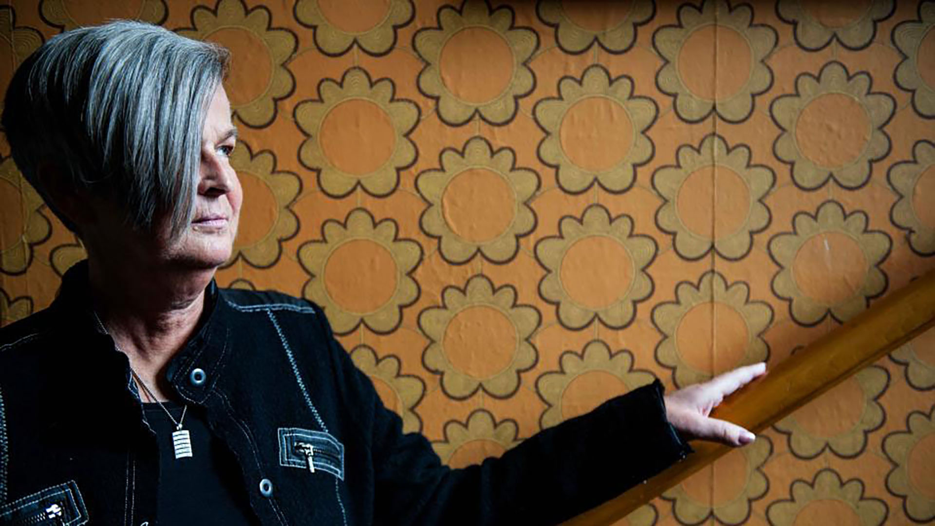 Sklerodermidiagnos Diagnos | Mer om systemisk skleros