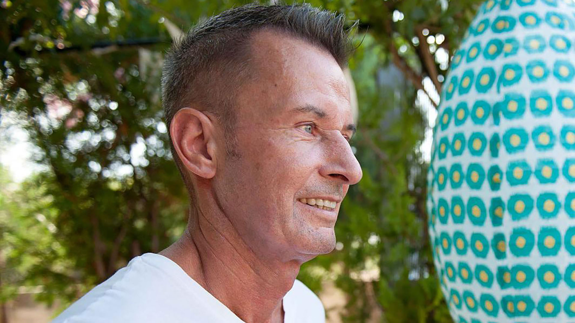 Systemisk skleros | More Than Scleroderma