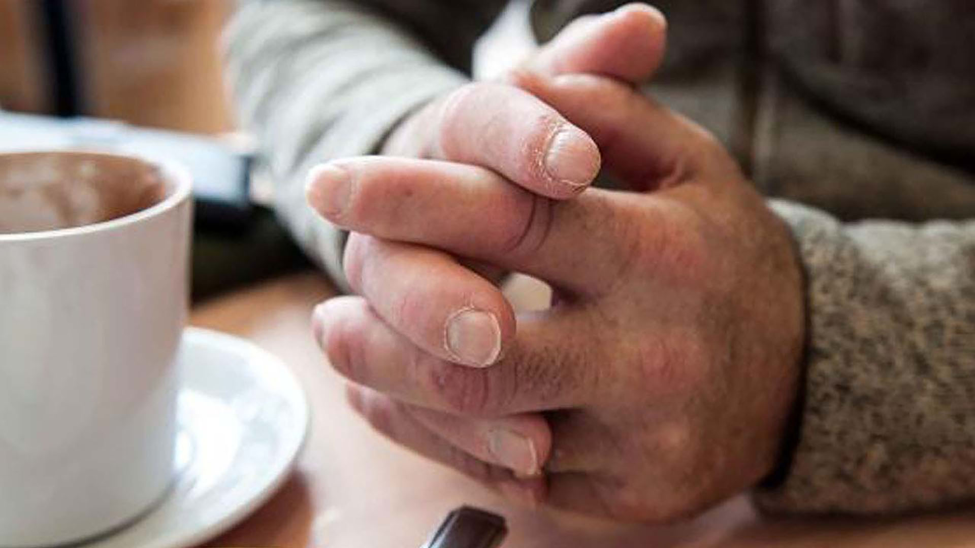 Symtom systemisk skleros | More Than Scleroderma