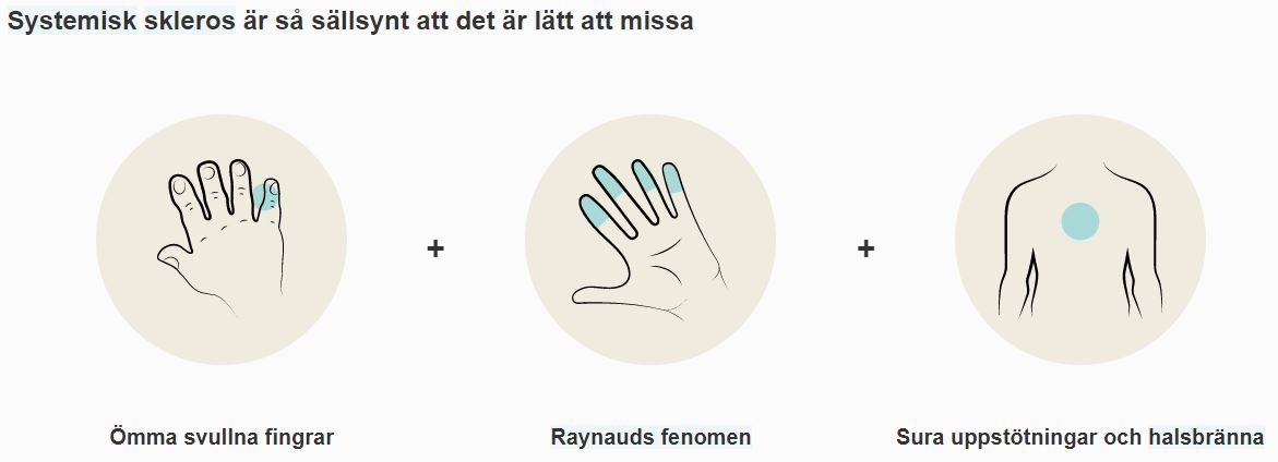 Vad är systemisk skleros | More Than Scleroderma