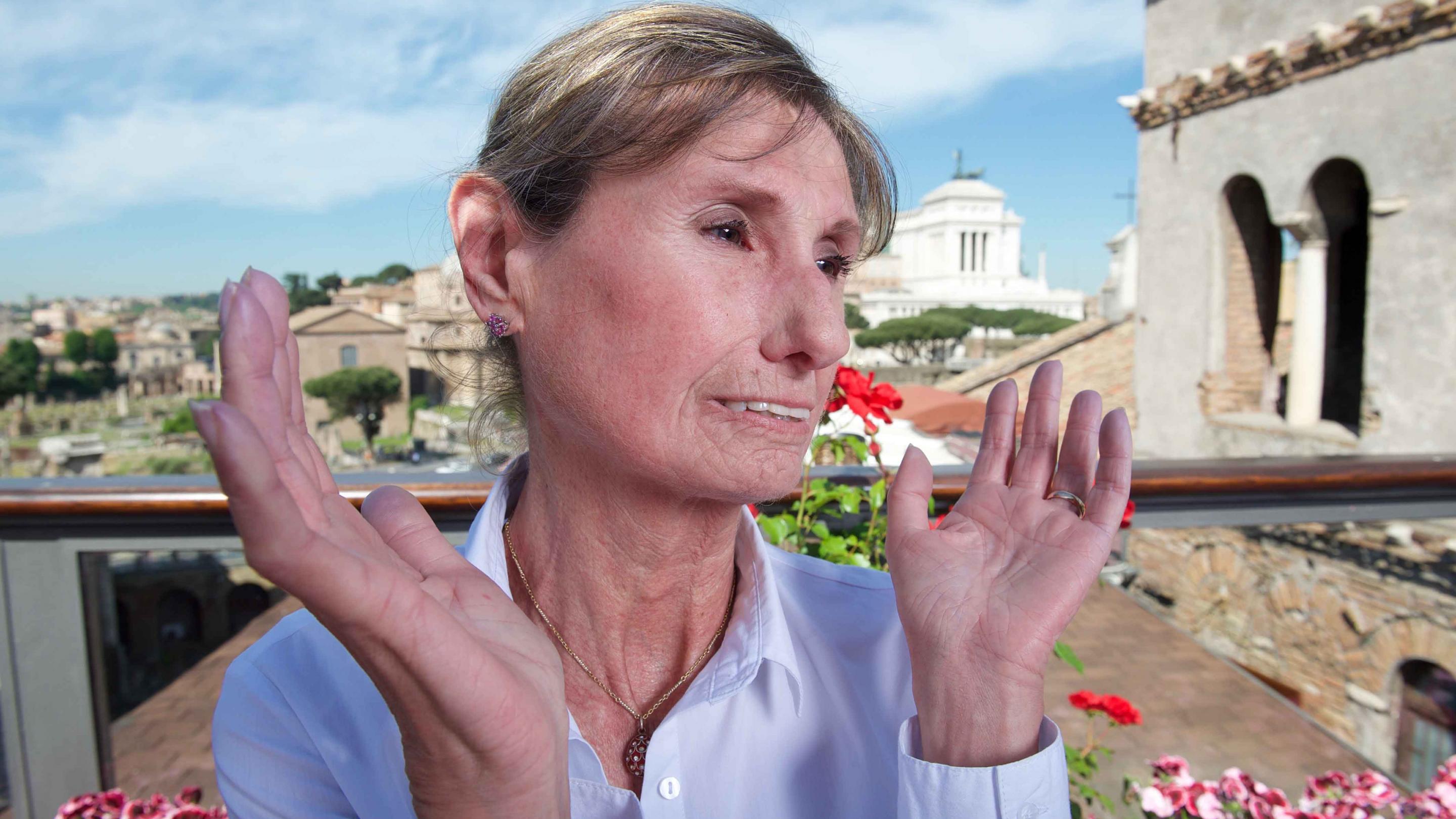 Skleroderma ile Yaşam