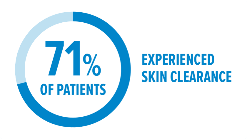 Chronic Plaque Psoriasis (Moderate to Severe) | Cyltezo® (adalimumab-adbm)
