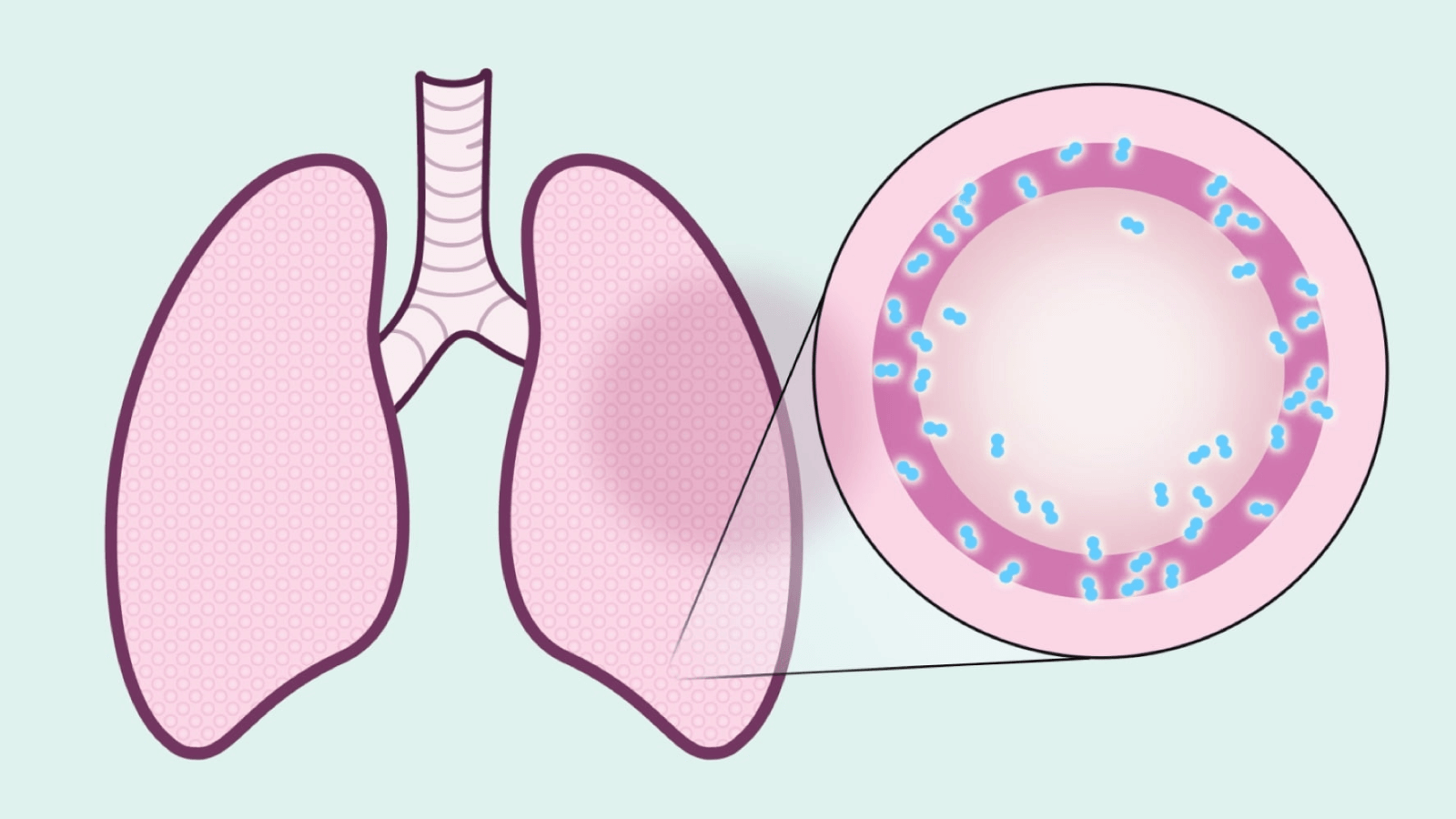 How Oxygen Can Help Manage IPF Symptoms | Lungs&You