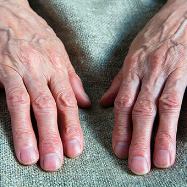 Learn About ILD & IPF Progression | Lungs&You